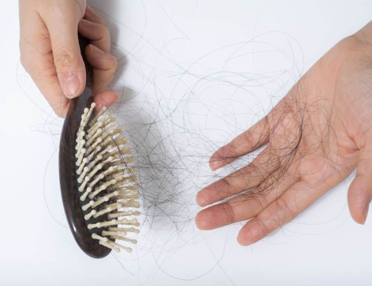 Beginilah Solusi Untuk Rambut Rontok Parah – Forum Kreatif